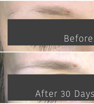 Acne-Prone & Sensitive Skin | Anti-Aging | Gritty Beauty